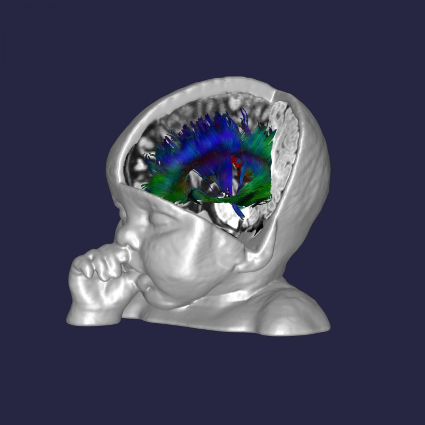 Baby Brain Connectivity [IMAGE] | EurekAlert! Science News Releases