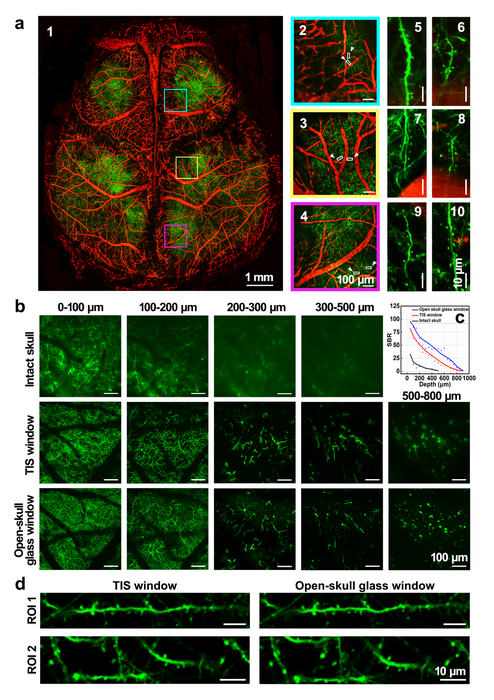 New approach to brain imaging leaves skulls i | EurekAlert!
