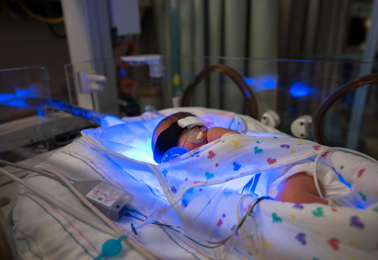 Infant Undergoing Phototherapy [IMAGE] | EurekAlert! Science News Releases