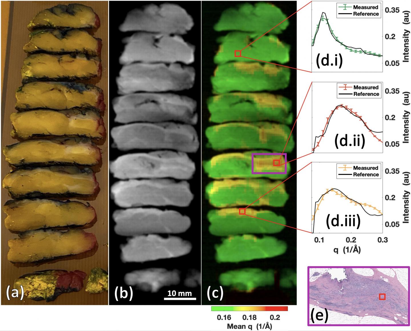 Biopsy Scan [IMAGE] | EurekAlert! Science News Releases