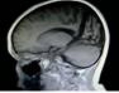 PQ disconnection with the activity of isolate | EurekAlert!