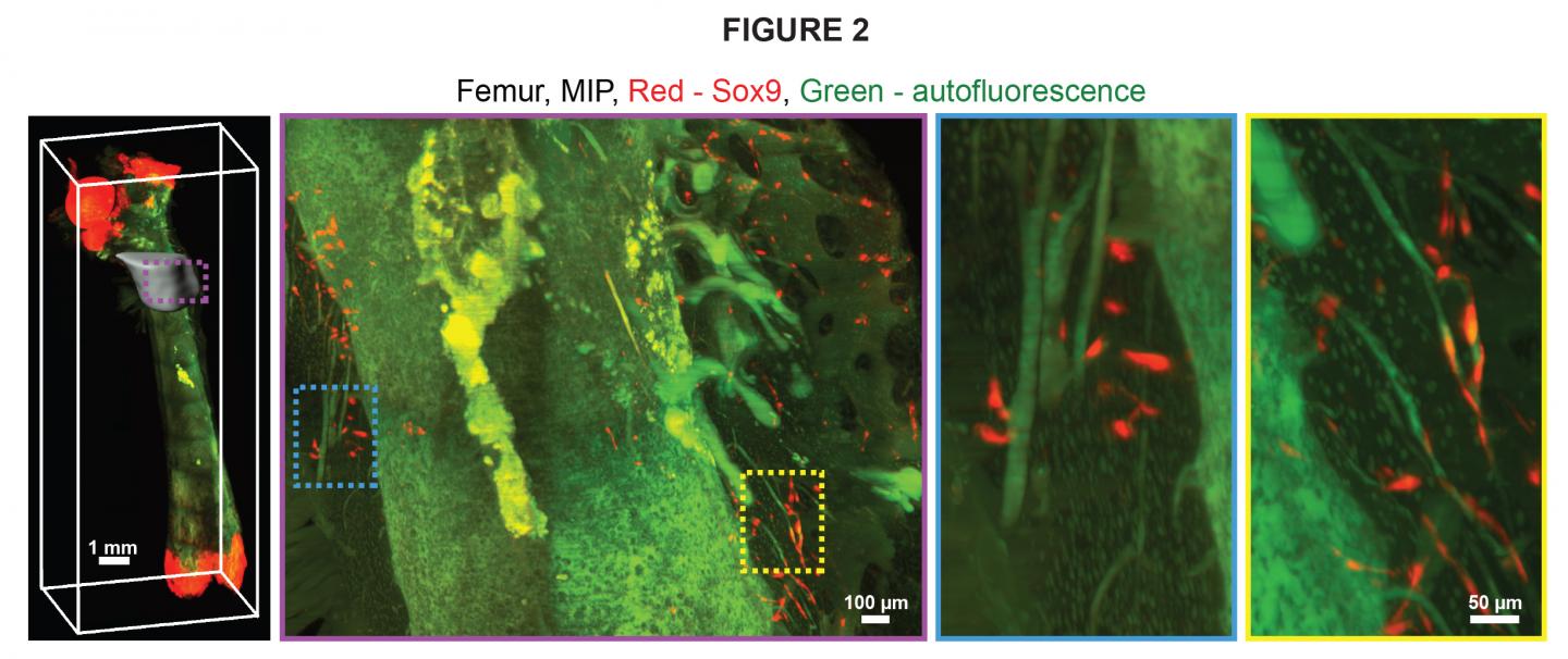 In the Clear: New Imaging Technique Makes Bon | EurekAlert!