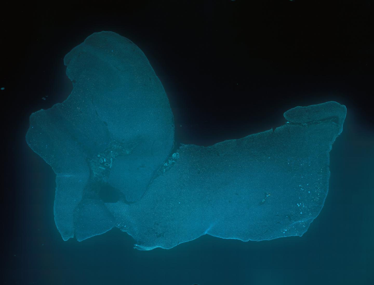 Thioflavin-S Staining [IMAGE] | EurekAlert! Science News Releases