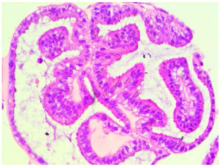 Endometrial Organoid [IMAGE] | EurekAlert! Science News Releases