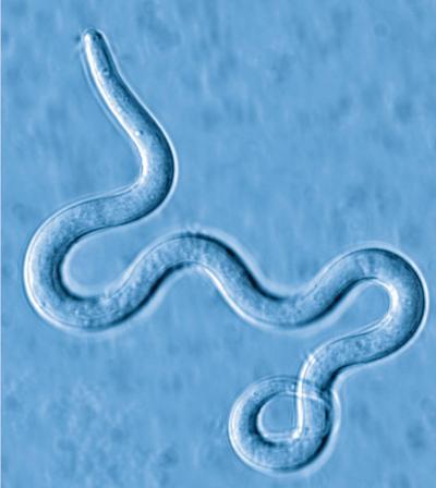 Unraveling the Elephantiasis Worm Genome (4 o | EurekAlert!