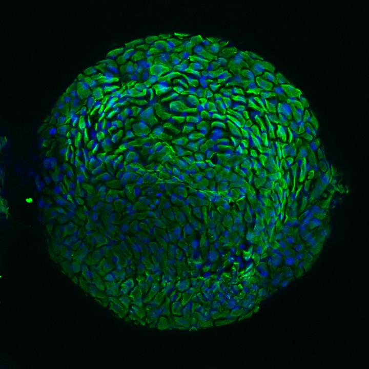 KRT14-positive ectocervical or [IMAGE] | EurekAlert! Science News Releases