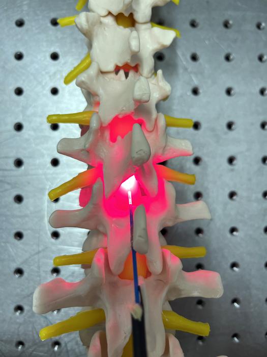 Surgery after spinal cord inju [IMAGE] | EurekAlert! Science News Releases