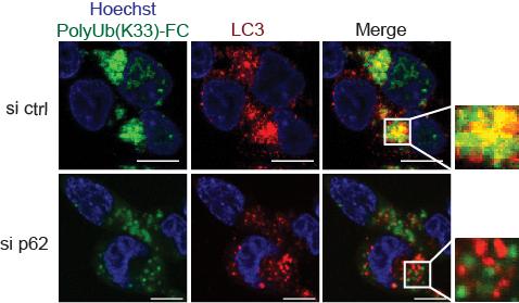 Colocalization [IMAGE] | EurekAlert! Science News Releases