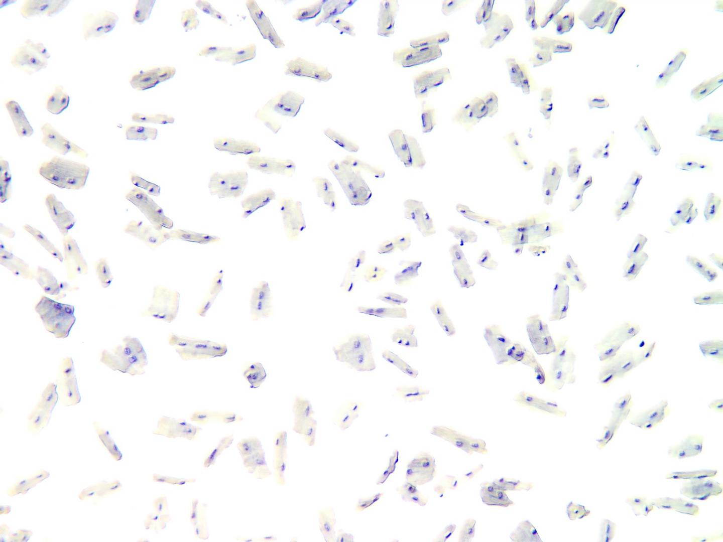 Cardiomyocytes [IMAGE] | EurekAlert! Science News Releases