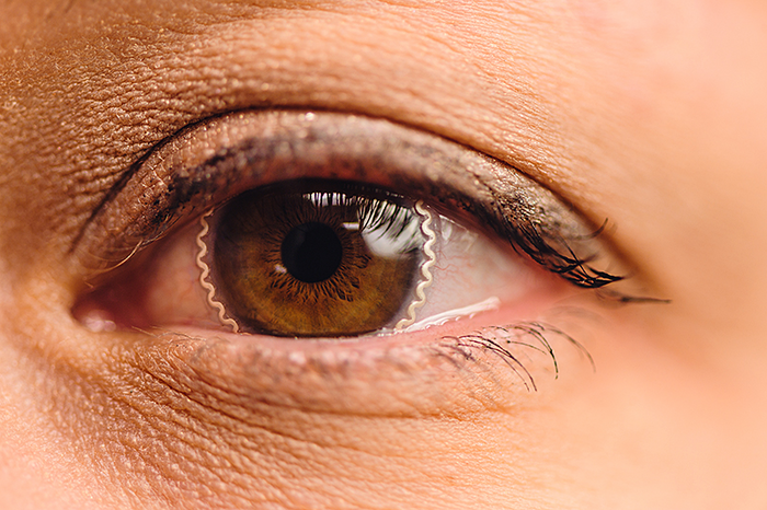 BVS Sight Lee [IMAGE] | EurekAlert! Science News Releases