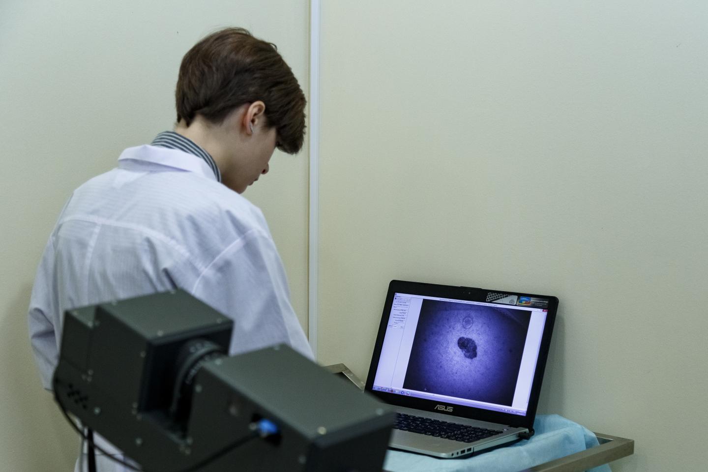 Diagnosis of Melanoma [IMAGE] | EurekAlert! Science News Releases