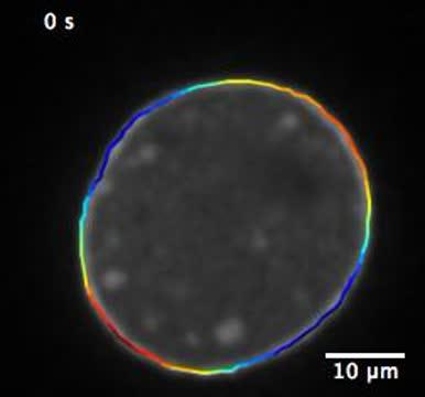 Dancing with the cells | EurekAlert!