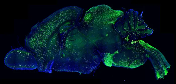 New method to reveal what drives brain diseas | EurekAlert!