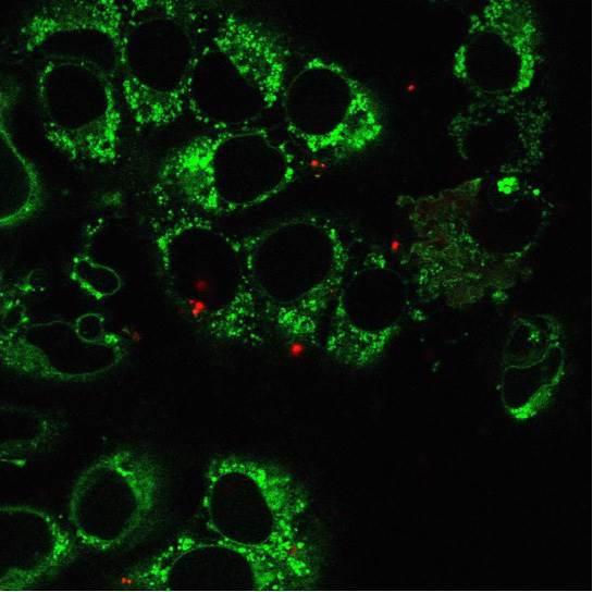 Modified Cells [IMAGE] | EurekAlert! Science News Releases