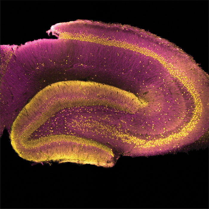 Scientists reveal where schizophrenia may ori | EurekAlert!