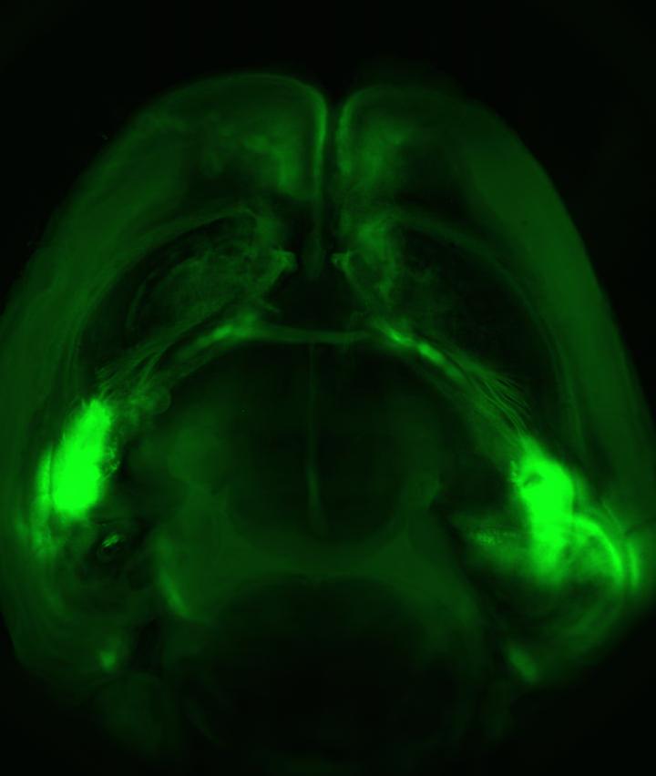 Mouse Brain [IMAGE] | EurekAlert! Science News Releases