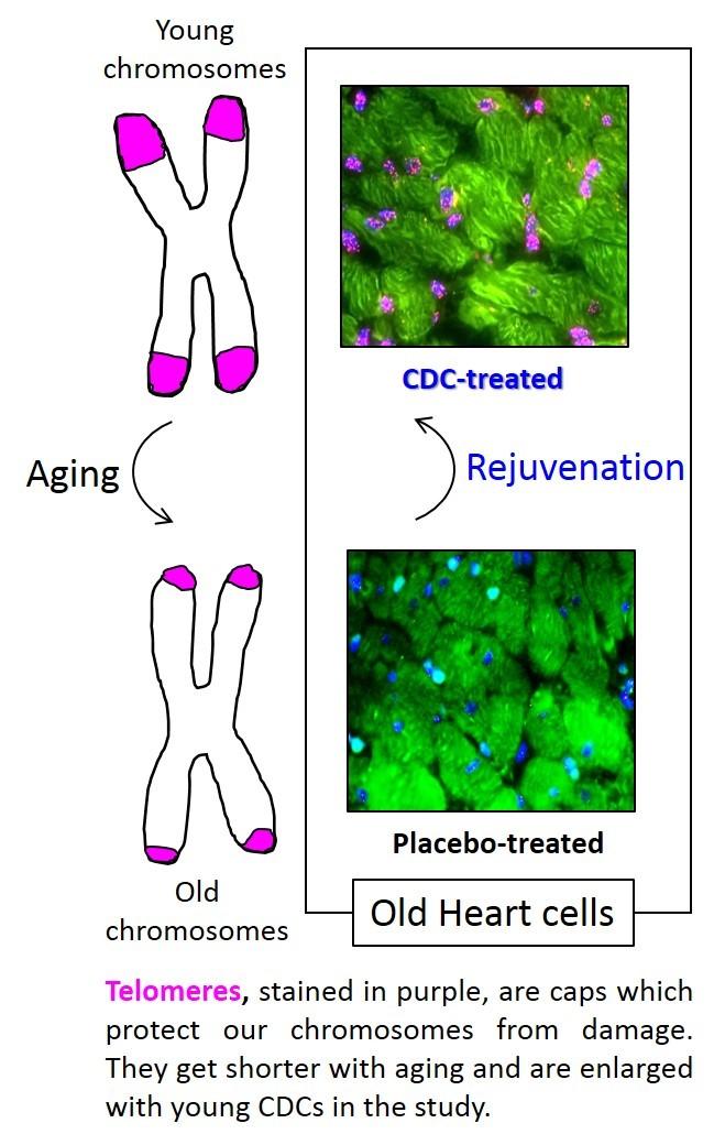 Telomeres [IMAGE] | EurekAlert! Science News Releases