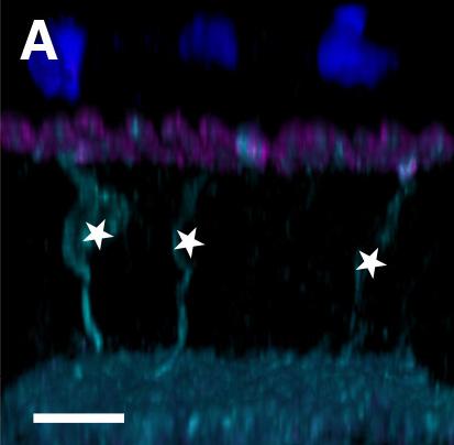 Retina Cross-section [IMAGE] | EurekAlert! Science News Releases