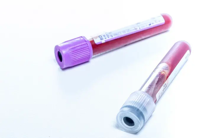 The liquid biopsy is a blood t [IMAGE] | EurekAlert! Science News Releases