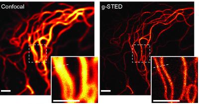 STED [IMAGE] | EurekAlert! Science News Releases