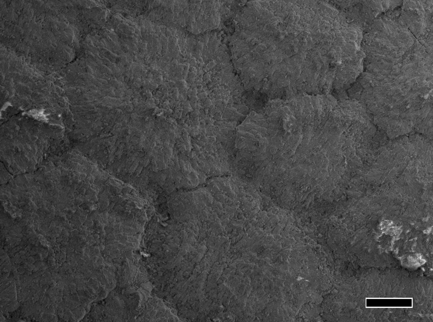 Platylithophycus SEM [IMAGE] | EurekAlert! Science News Releases