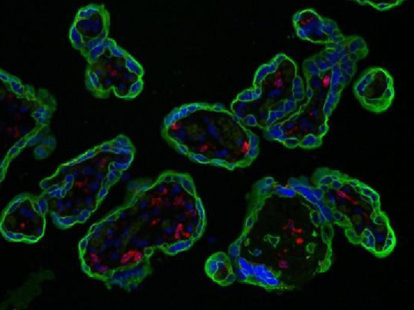 CD74 in the Placenta [IMAGE] | EurekAlert! Science News Releases