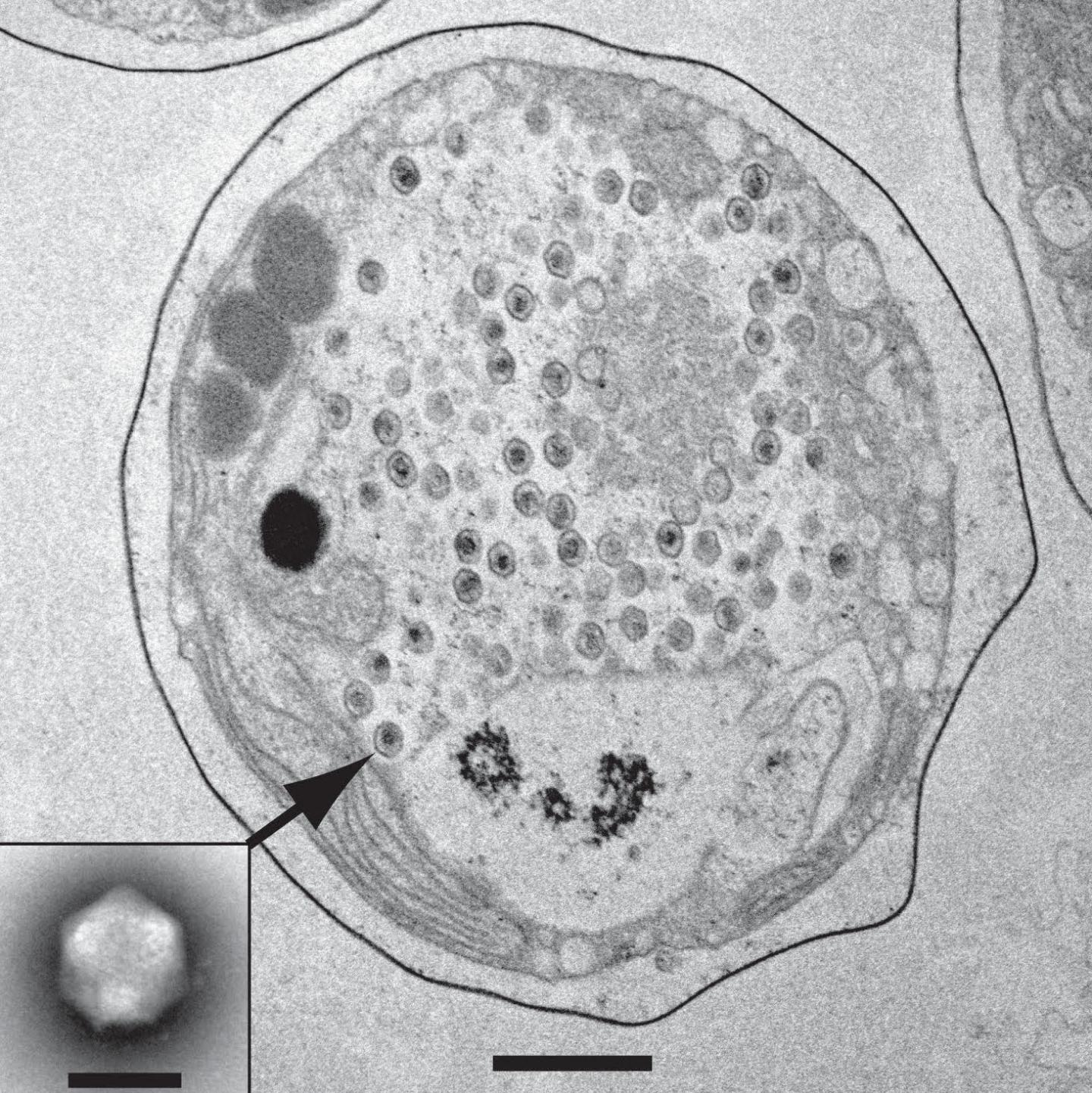 TetV Virus [IMAGE] | EurekAlert! Science News Releases