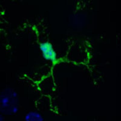 Microglia [IMAGE] | EurekAlert! Science News Releases