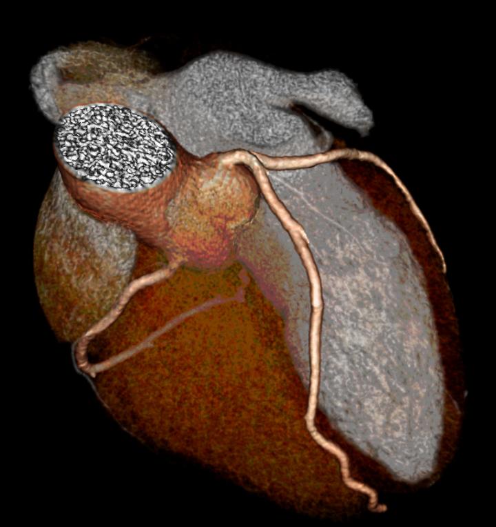 Cardiac CT Scan from the Multi [IMAGE] | EurekAlert! Science News Releases