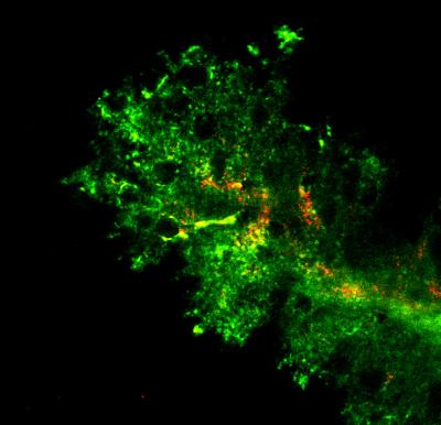 Brain-Penetrating Nanoparticles (2 of 3) | EurekAlert!