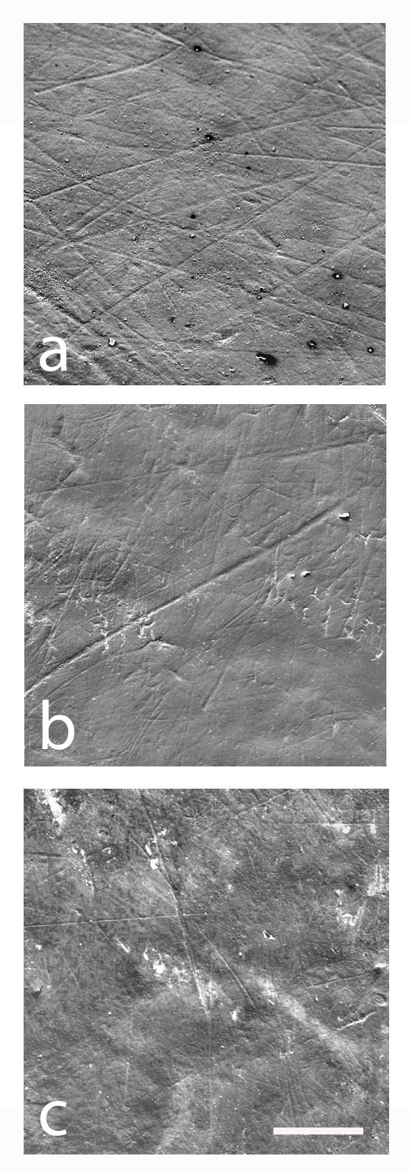 Tooth wear patterns suggest Paranthropus earl | EurekAlert!