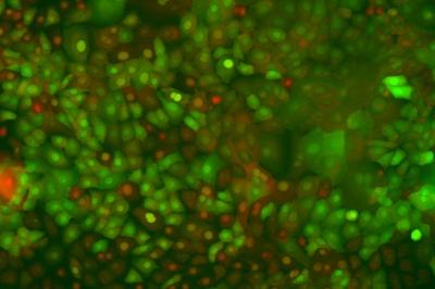 Genetically Altered Skin Cells [IMAGE] | EurekAlert! Science News Releases