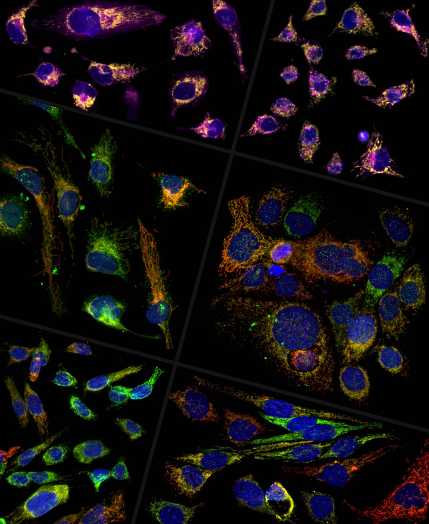TNBC Cell Lines [IMAGE] | EurekAlert! Science News Releases
