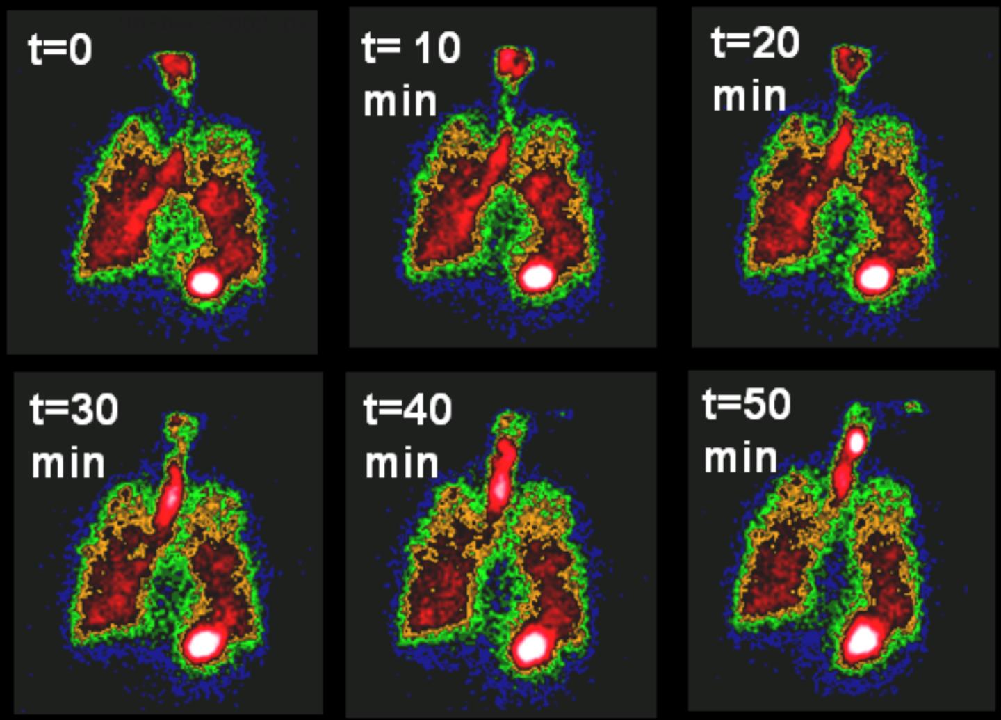 Time-Lapse of Mucus in the Lun [IMAGE] | EurekAlert! Science News Releases