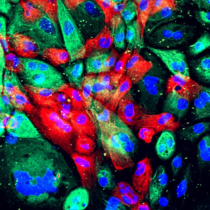 Human Prostate Cells [IMAGE] | EurekAlert! Science News Releases