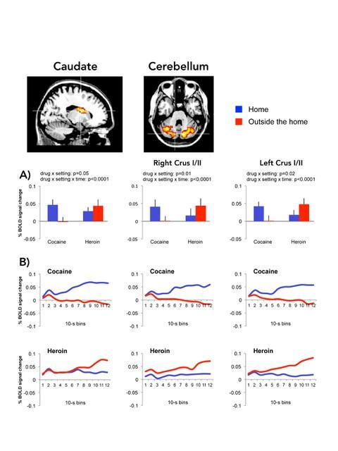 Caudate and Cerebellum [IMAGE] | EurekAlert! Science News Releases