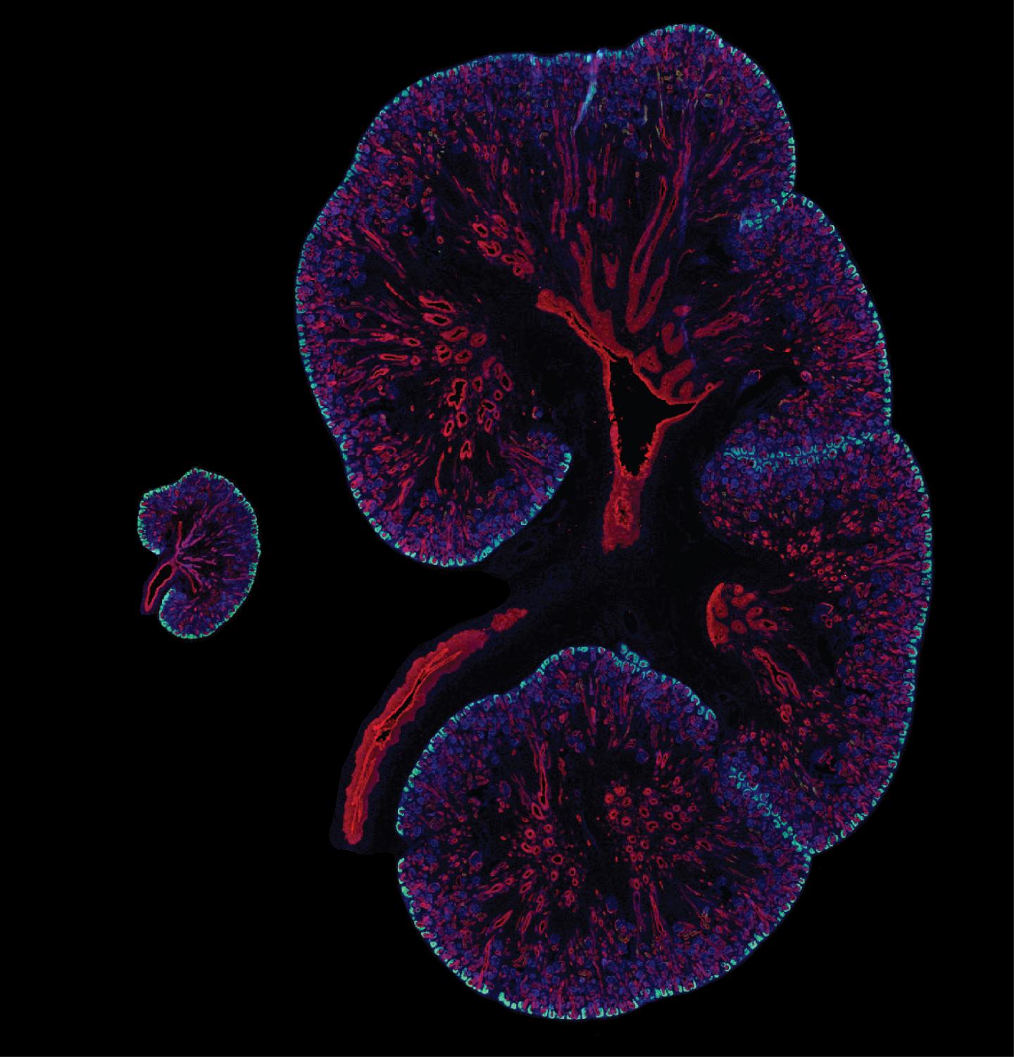 Mouse and Human Kidneys [IMAGE] | EurekAlert! Science News Releases