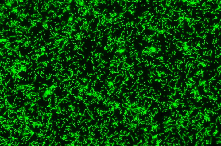 Streptococcus mutans Bi [IMAGE] | EurekAlert! Science News Releases