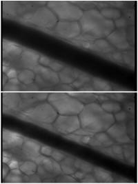 Hyperviscous fluids: Better treatment for sev | EurekAlert!