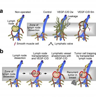 Lymphatic vessel and lymph node function are | EurekAlert!