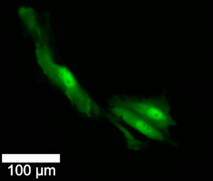 cancer cells [IMAGE] | EurekAlert! Science News Releases