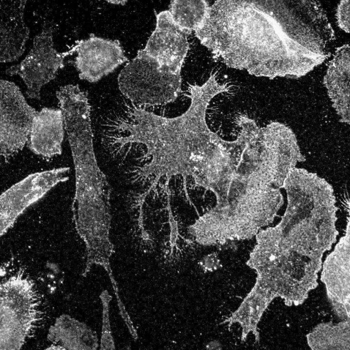 Microglia Cells [IMAGE] | EurekAlert! Science News Releases