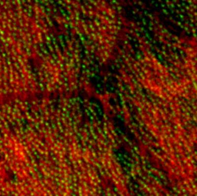 Schmidtea mediterranea [IMAGE] | EurekAlert! Science News Releases