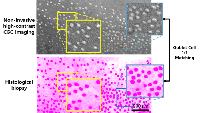 Non-invasive examination of conjunctival gobl | EurekAlert!