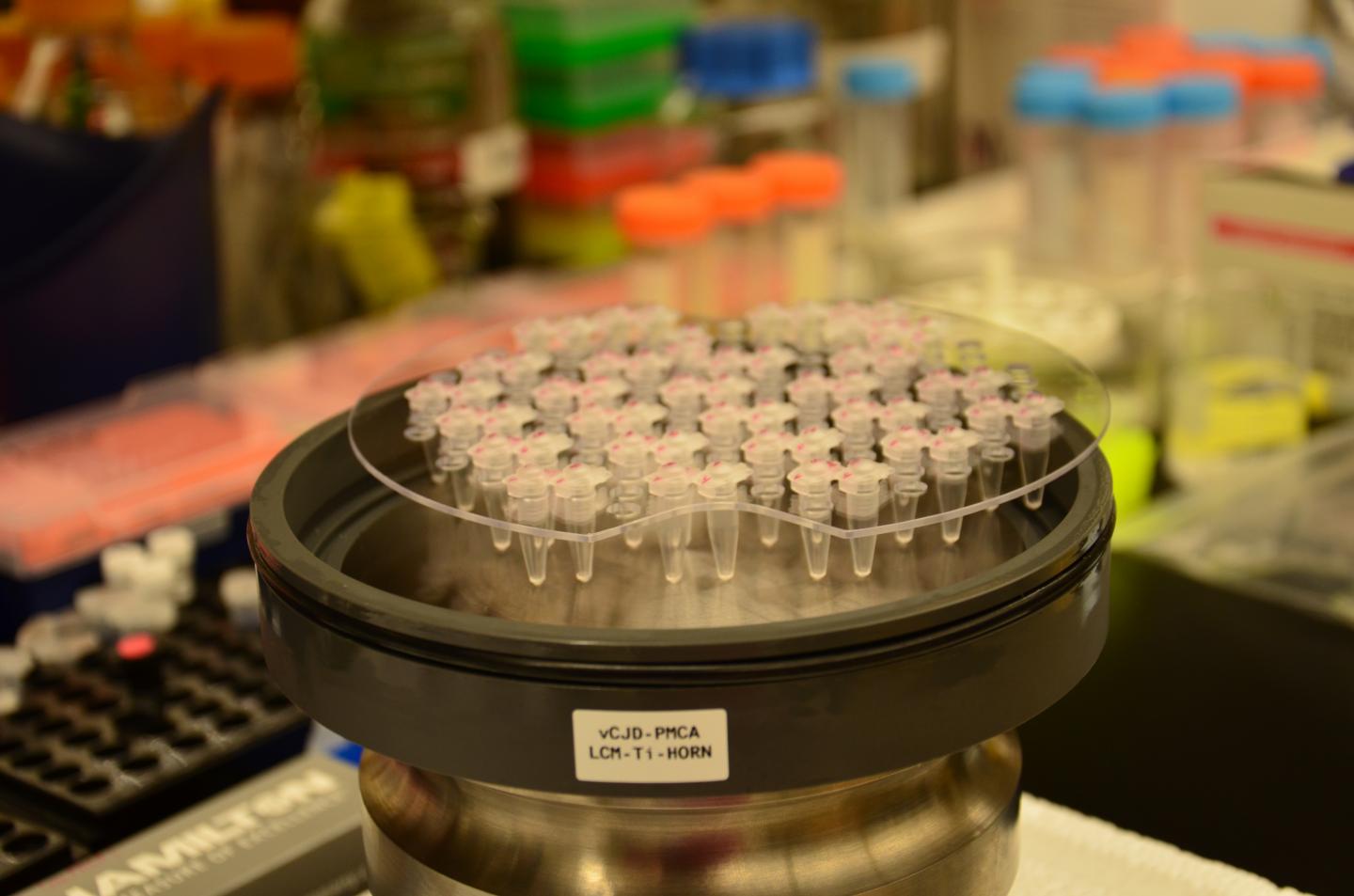 Blood Test for Prion Disease Could Make Blood | EurekAlert!