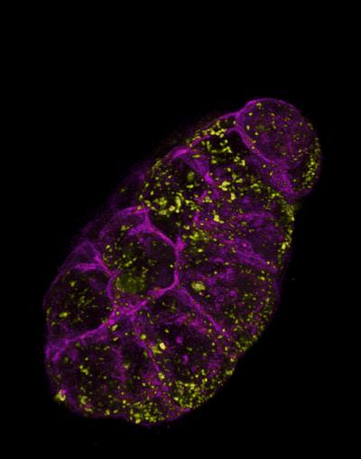 Under the Microscope, Shape-Shifting Cells (1 | EurekAlert!