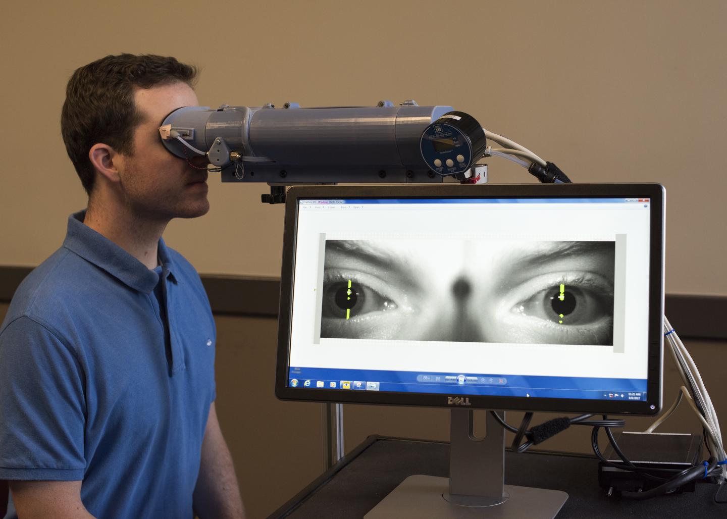 Concussion detection aid moves closer to gett | EurekAlert!