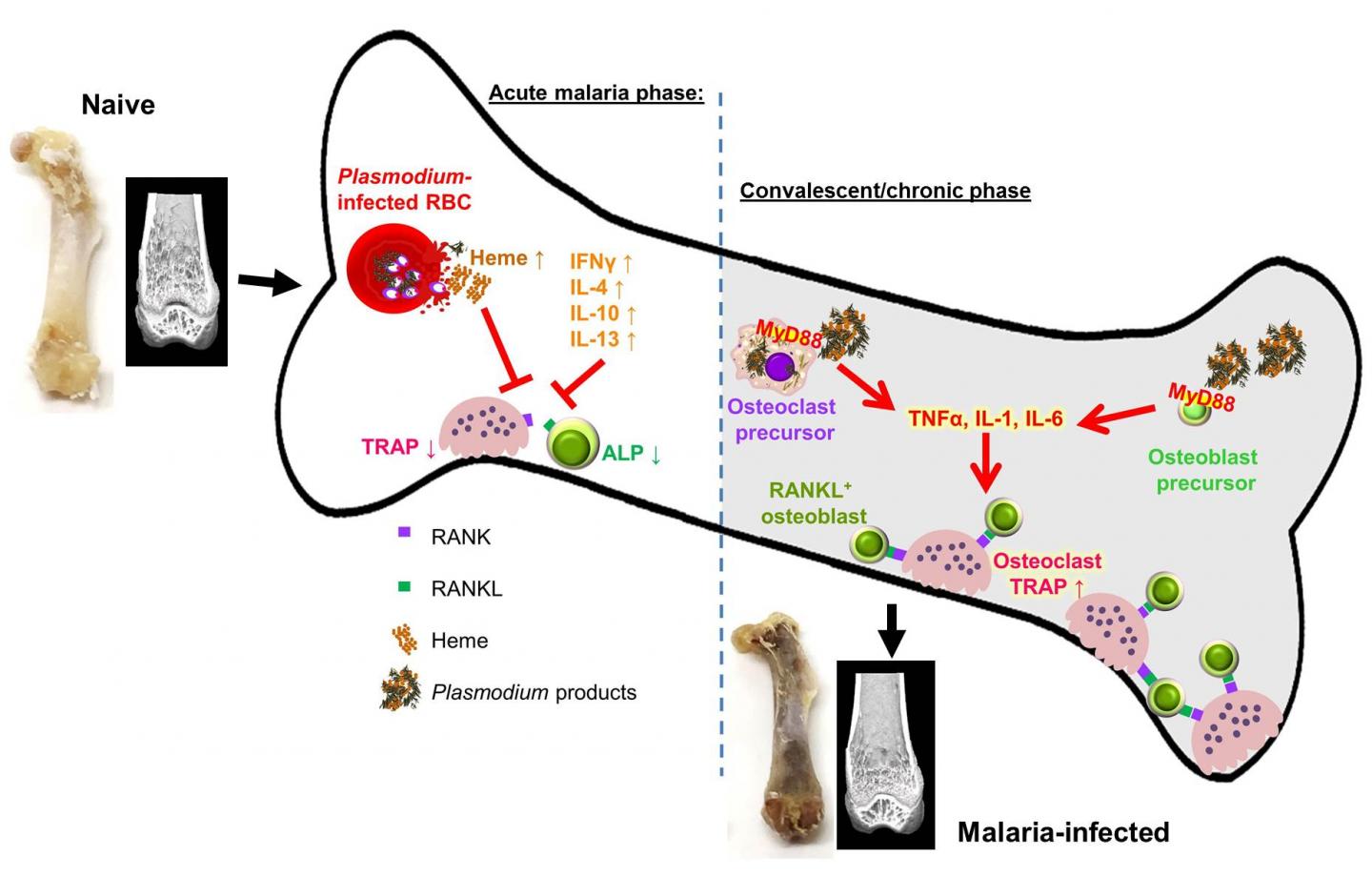Bone loss is another hidden pathology caused | EurekAlert!