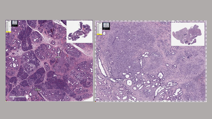 Johns Hopkins study: Anti-parasitic drug slow | EurekAlert!