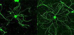 Neurons from Adult Mouse Spina [IMAGE] | EurekAlert! Science News Releases
